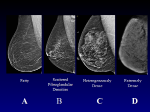 What should you know about breast density? | Breast Cancer Awareness ...